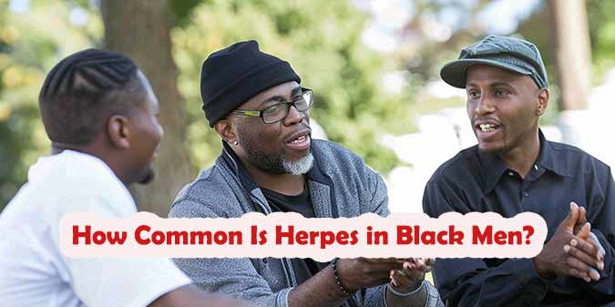How Common Is Herpes in Black Men? Facts, Data, and Awareness